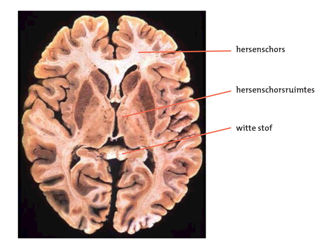 Parkinson - Poiesz Uitgevers